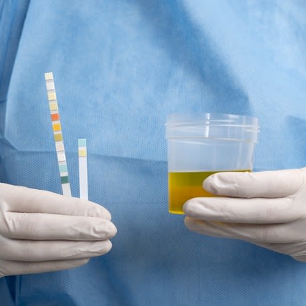 Urine Test: Functions, Collection, and Prices