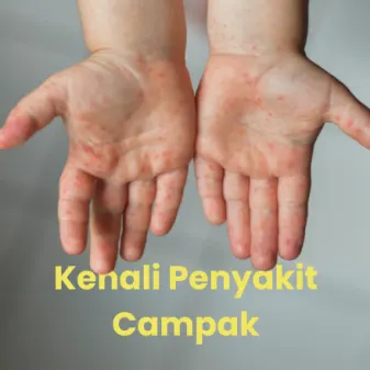 Bronkitis: Gejala, Penyebab, Jenis, dan Cara Pencegahannya