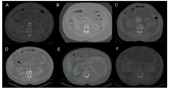 YOLO Object Detection Explained: A Beginner's Guide | DataCamp