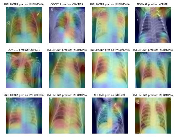 A Complete Guide to Data Augmentation | DataCamp