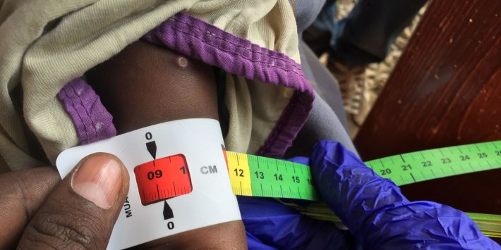 East Africa Hunger Crisis Demands Urgent Action from UK Government