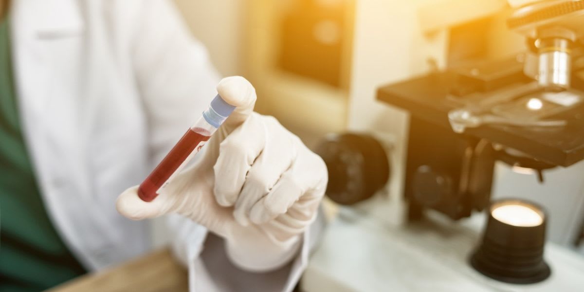 How Comprehensive Blood Tests Support Elite Wellness Goals | Walk in Clinic
