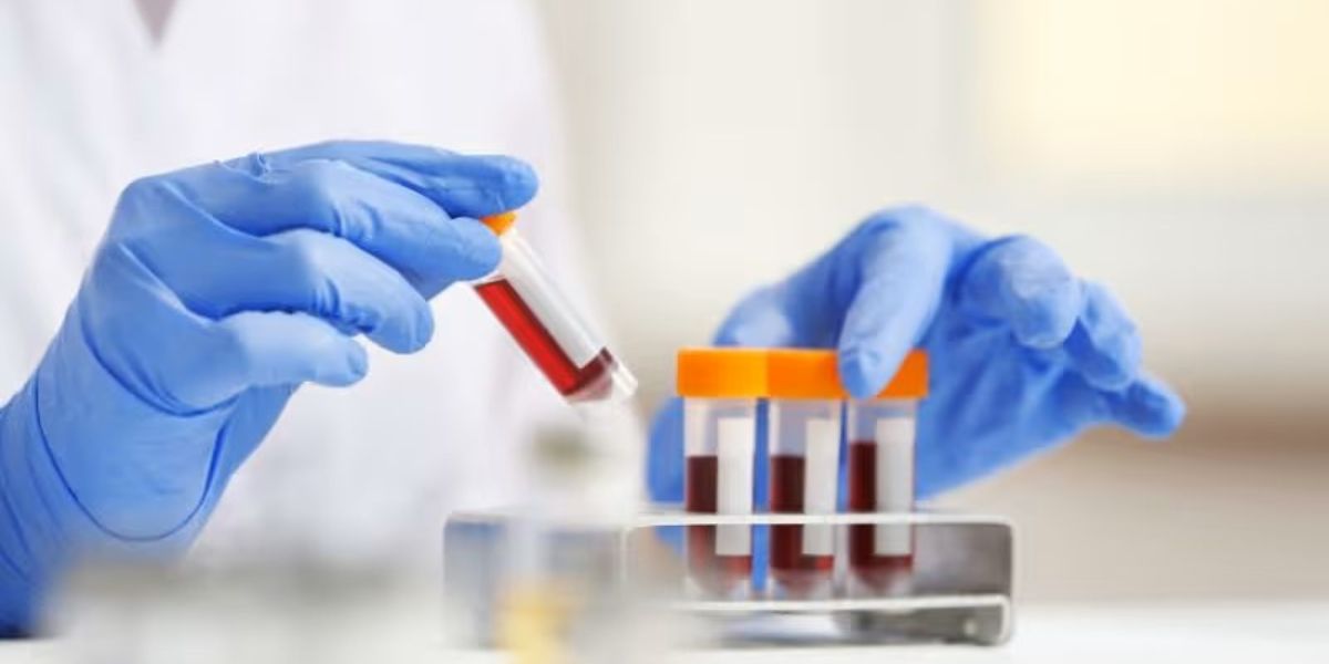 Fasting Before a Blood Test: Can I Drink Water & What to Do? | Walk in ...