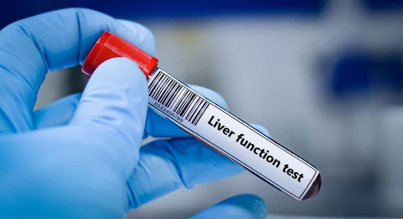 Fatty Liver Detection via Blood Test | UK Liver Health Screening Guide ...