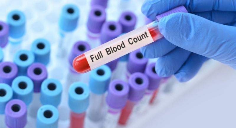 Full Blood Count Test for Fatigue Causes | UK Health Screening Guide ...