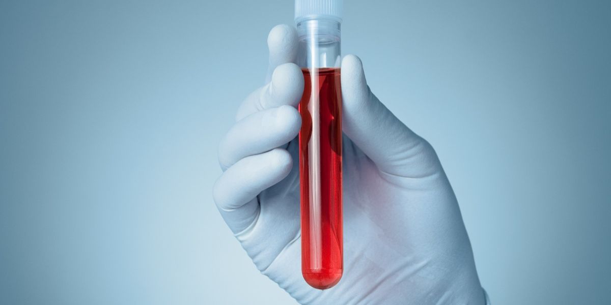 Reliable Private Blood Tests for Your Peace of Mind | Walk in Clinic