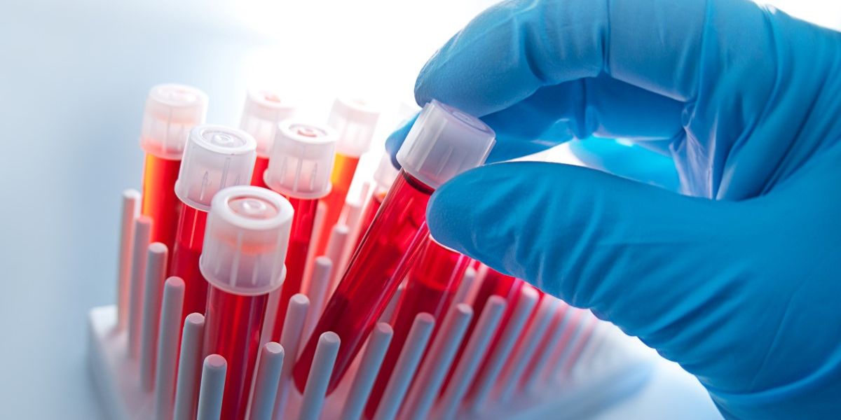 Why Private Blood Tests Offer Faster Results in London | Walk in Clinic