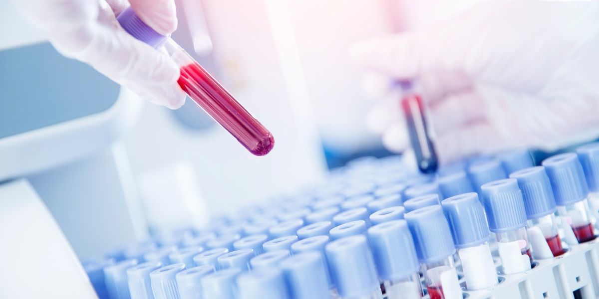 Private Blood Test: How to Monitor Your Health Markers | Walk in Clinic