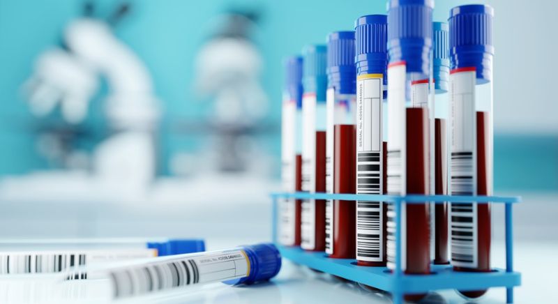 How to Manage and Improve Your Blood Health Better | Private Blood ...