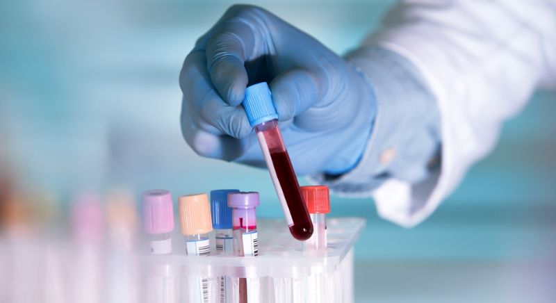 Platelet Counts & Clotting Disorders – Blood Test Guide | Private Blood ...