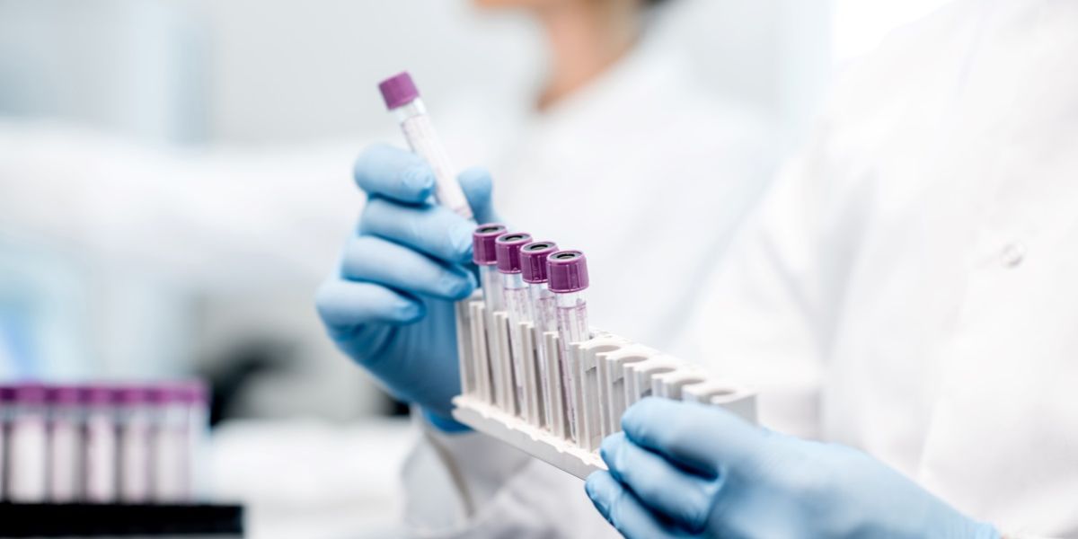Full Blood Count (FBC): One of the Most Commonly Requested Baseline ...