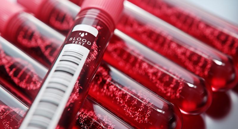 Phlebotomy Fees Explained – Why the £50 Charge Is Worth It | Private ...