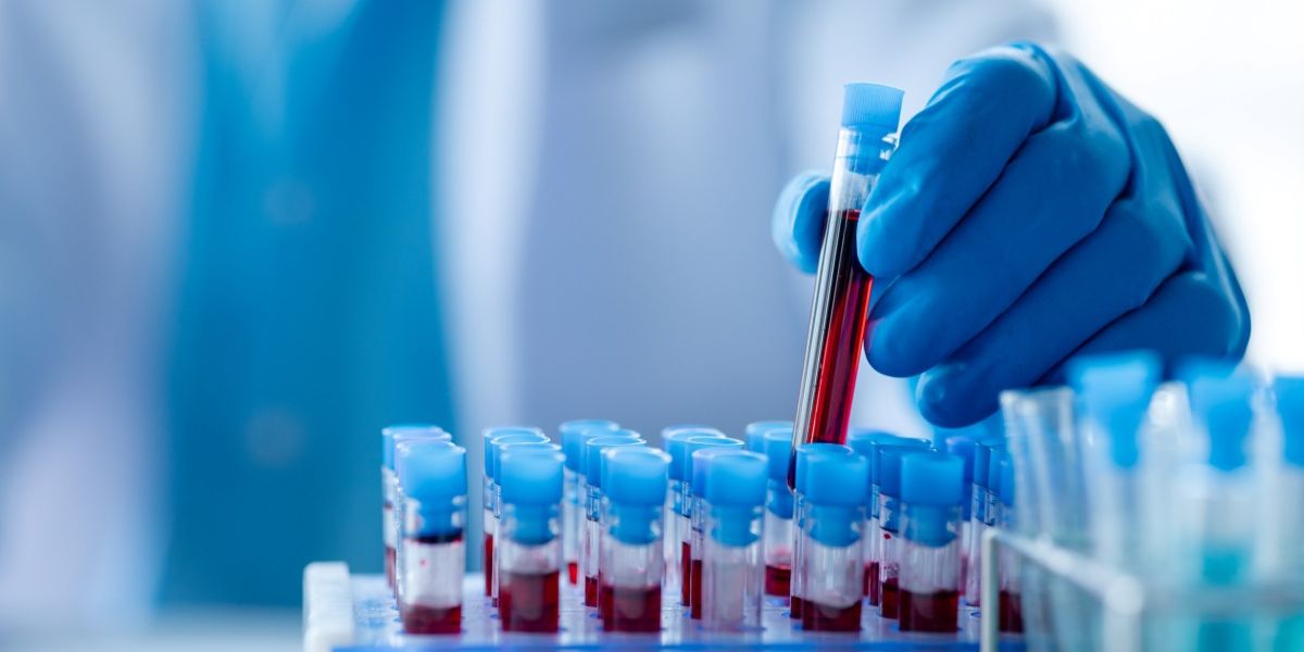Understanding Active B12 vs Total B12 Blood Test Results | Walk in Clinic