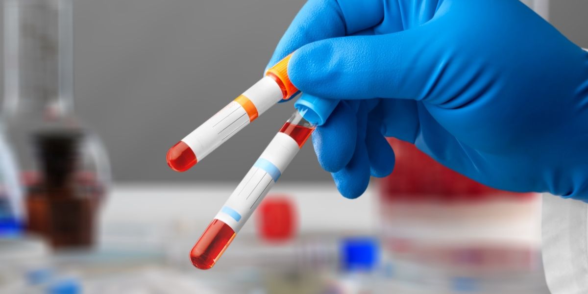 Clinical Overview of Advanced Well Woman Blood Test Panels | Walk in Clinic