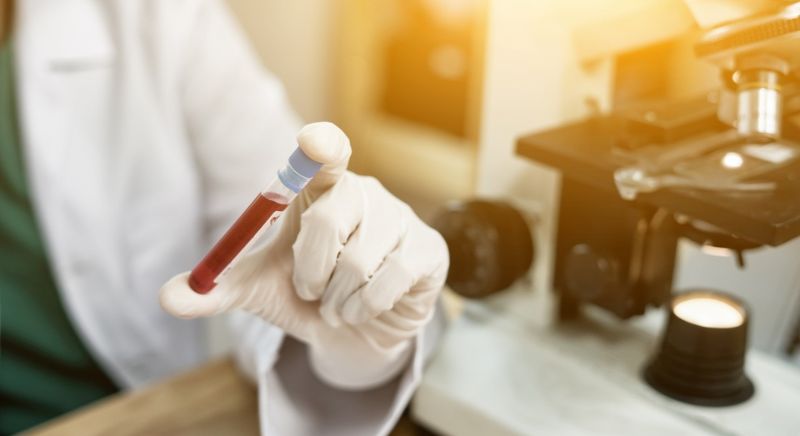 The Importance of Regular Prostate Scree... | Private Blood Tests London