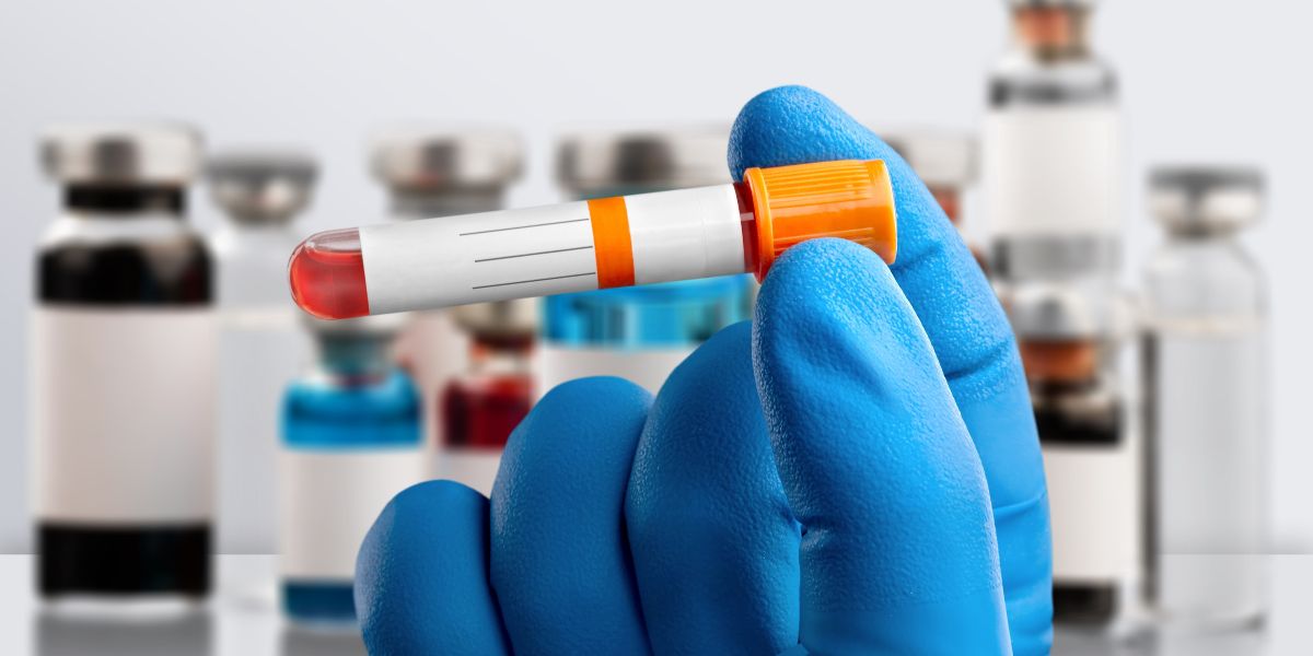 The Science Behind Modern Laboratory Blood Testing | Walk in Clinic