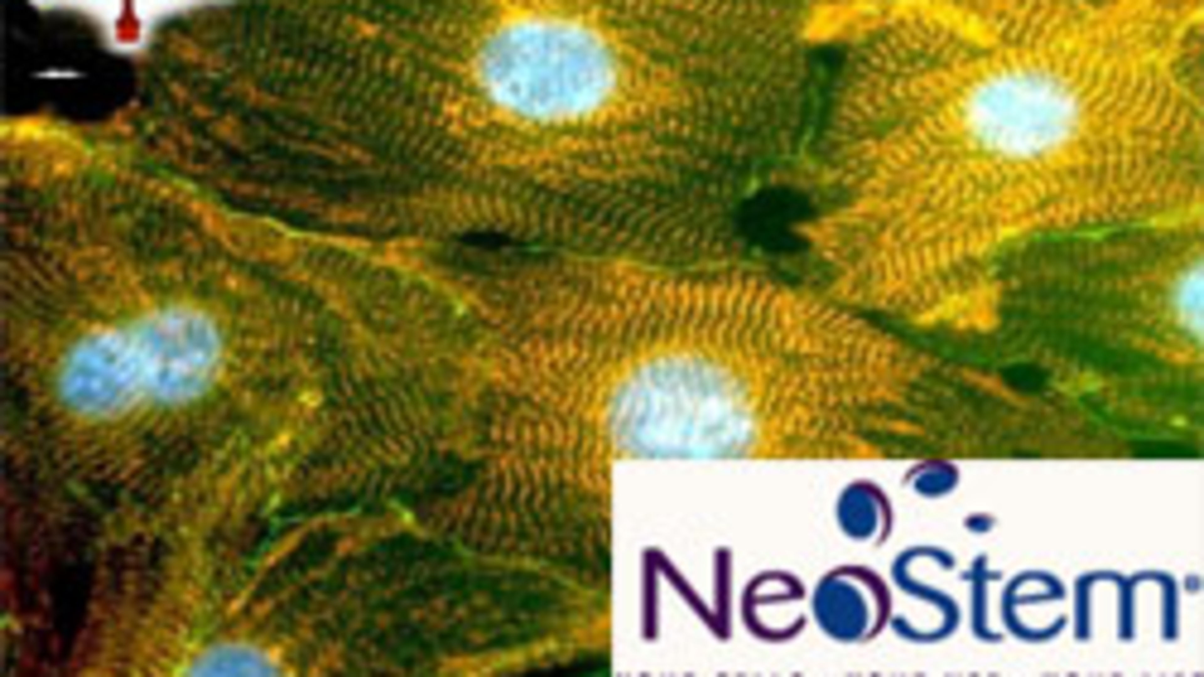 Catholic Church announces adult stem cell venture with Neostem