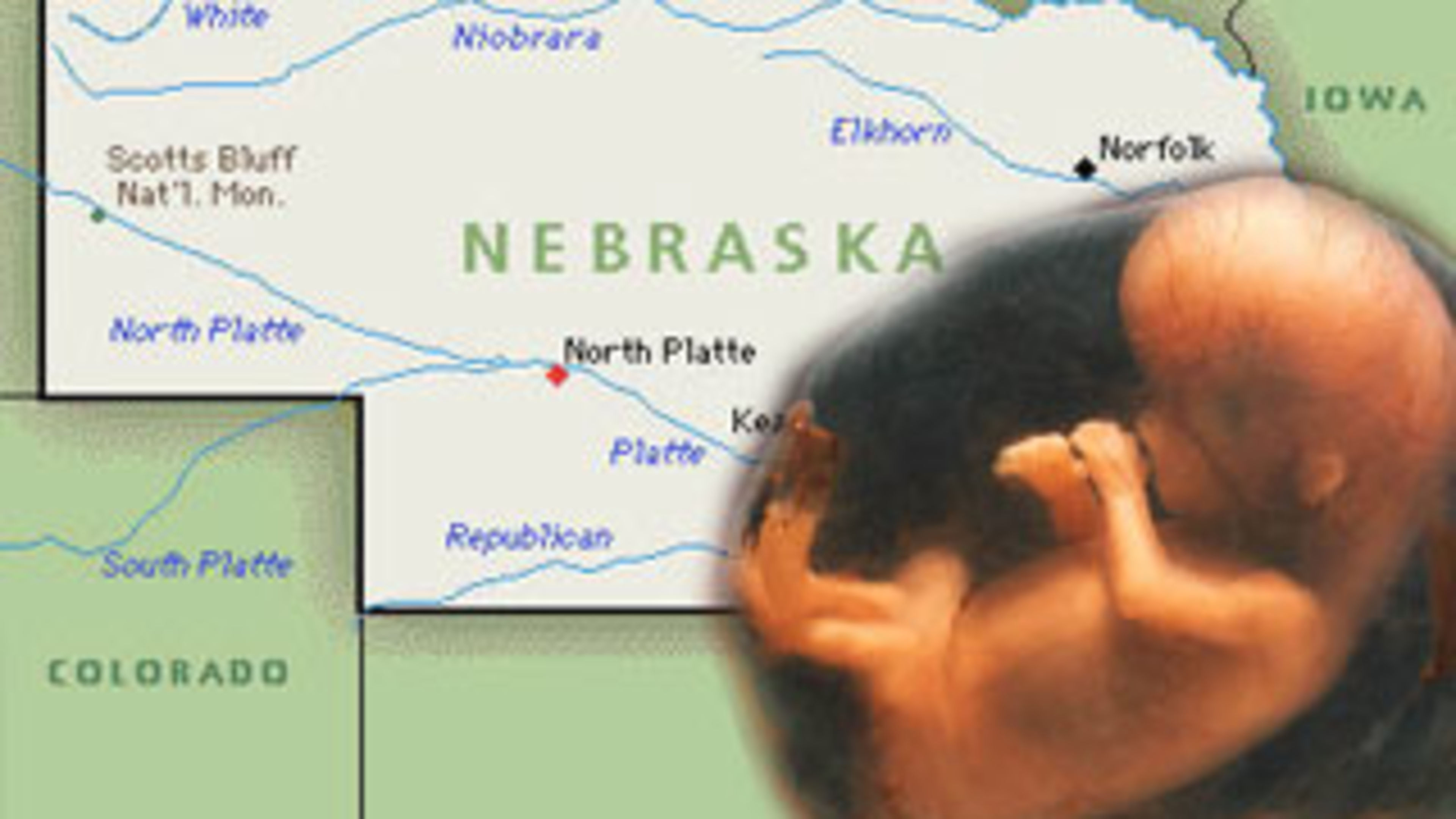 Nebraska attorney general declines to defend state's pro-life law