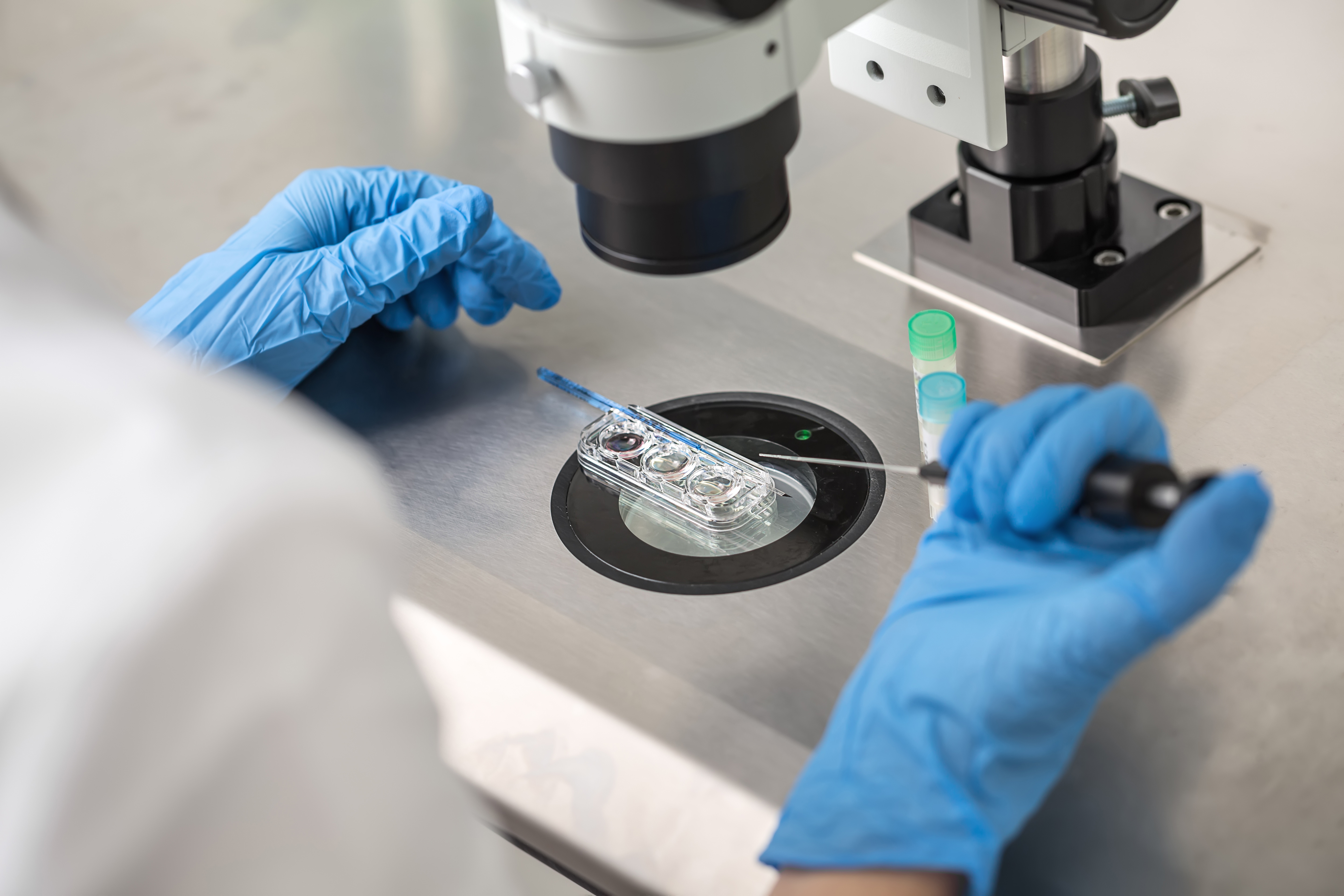 Alabama Senate passes IVF protection bill amid Catholic outcry