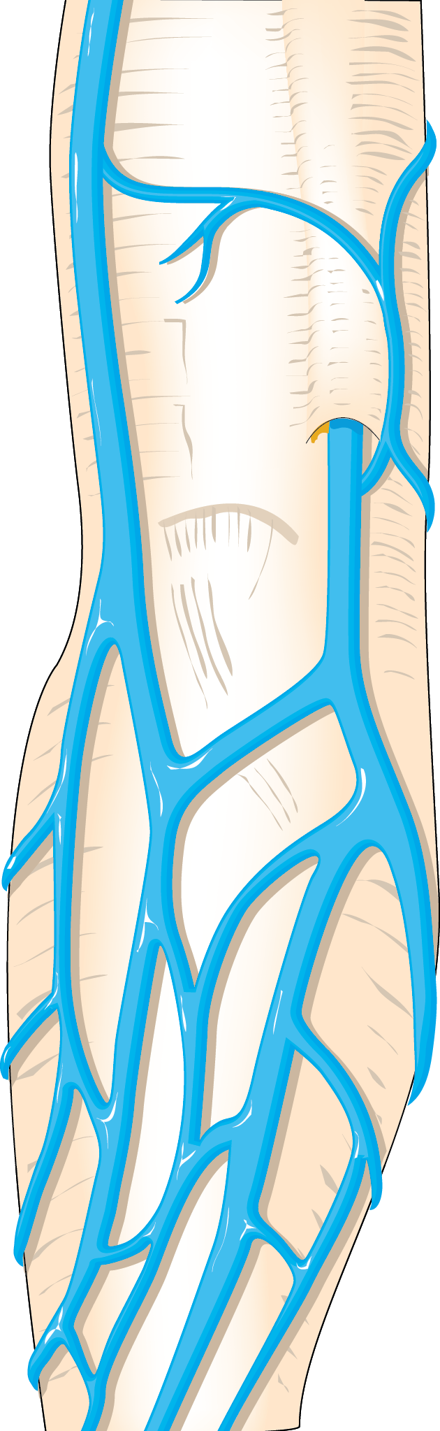 Venepuncture and IV Cannulation (1/5) - Indications and vein selection