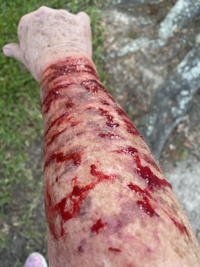 snake attacks on humans