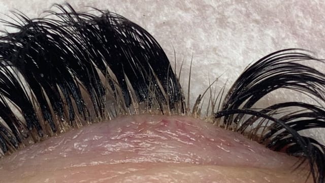 eyelash extensions worms