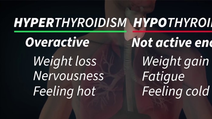hyperthyroidism weight loss reason