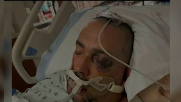Lawsuit filed against Harris County after man claims jailers beat him ...