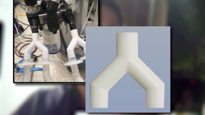 Local doctors create 3D-printed “splitter template” amid growing need ...