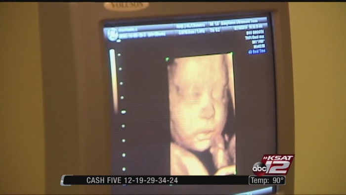 Doctors warn of using ultrasounds for entertainment