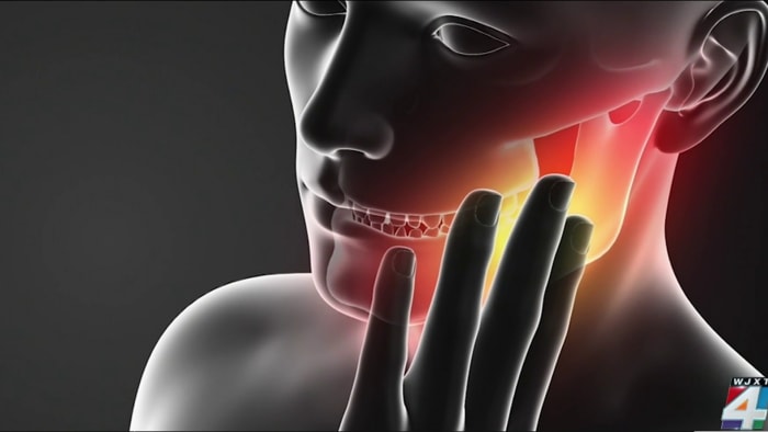 4 Your Smile: Teeth grinding, clenching up 69% since 2020, dentists say