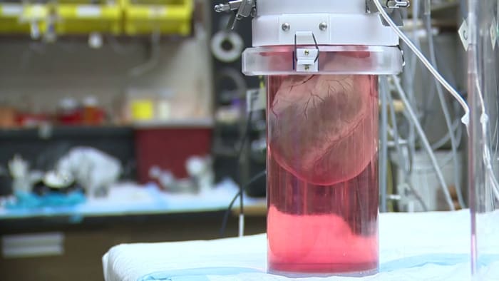 Revolutionary organ transplant device preserves organs, limbs for at ...