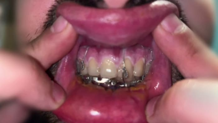 Police investigating after man’s jaw shattered in attack at Dearborn ...