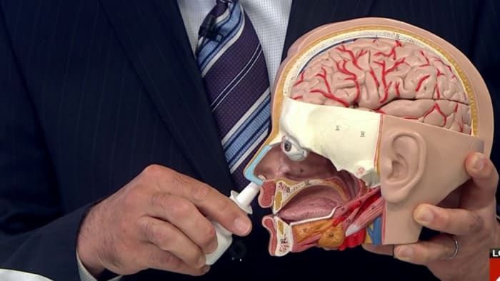 Video demonstration: How to properly use nasal spray