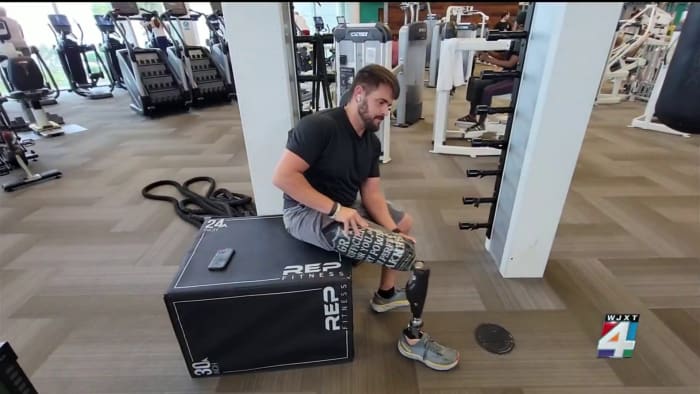 DUI crash survivor who had his leg amputated warns: ‘Don’t make the ...