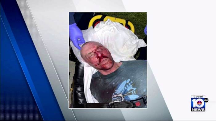Man badly injured by deputies in rough arrest now suing Palm Beach ...
