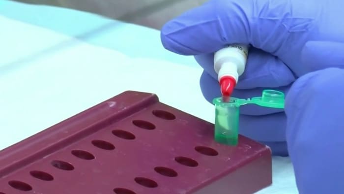Pfizer announces massive contract for coronavirus (COVID-19) vaccine if ...
