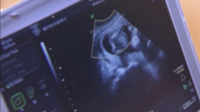 Texas’ First Illegal Abortion Case: Maria Rojas in Court Today