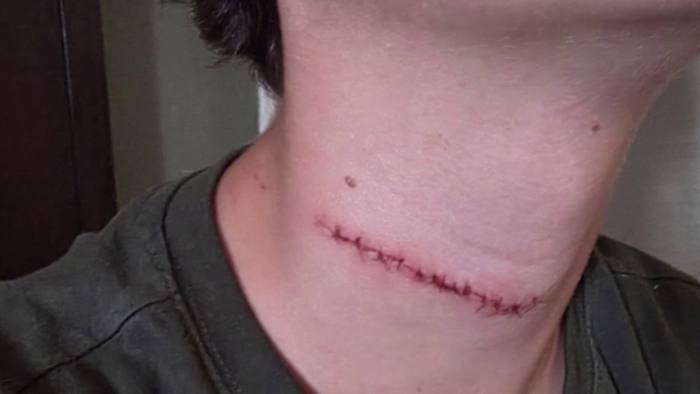 Family seeks answers after son’s neck slashed in Daytona Beach by man ...