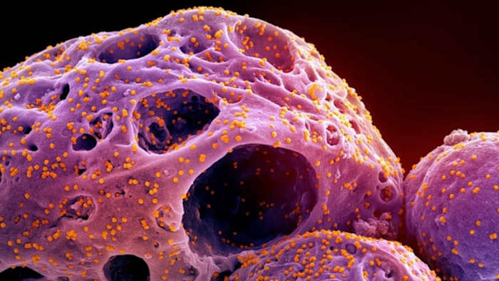 What’s Going Around in Metro Detroit: RSV, sinus infections, COVID ...