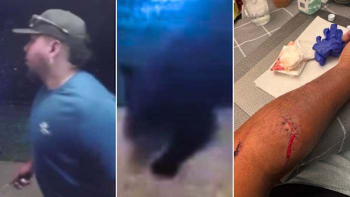 florida bear attacks man