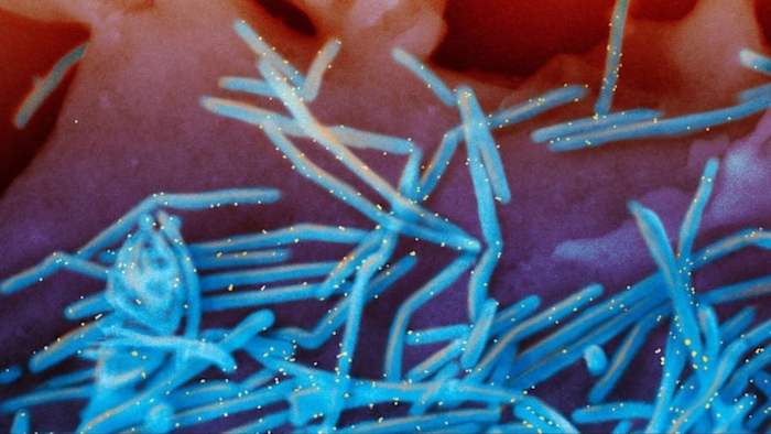 What’s Going Around in Metro Detroit: Influenza, COVID, slip and fall ...