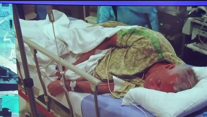 Why you shouldn't delay getting screened for colorectal cancer