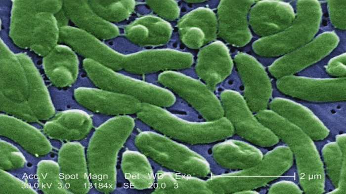 Health advisory for rare bacteria outbreak