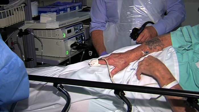 The importance behind screening for colorectal cancer symptoms