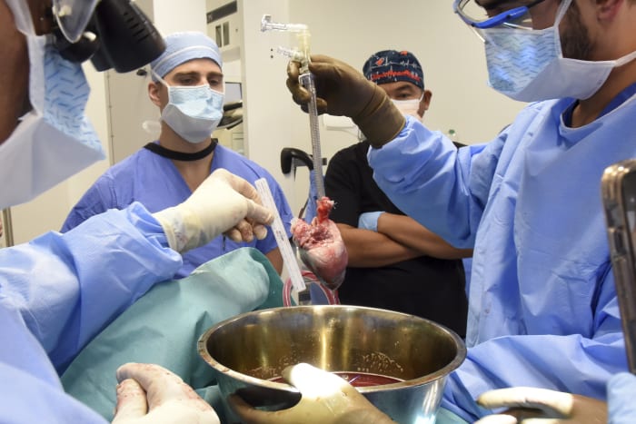 Surgeons perform second pig heart transplant, trying to save a dying man