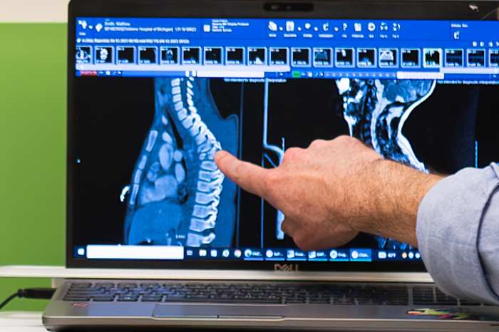 Understanding pediatric spinal trauma: What parents need to know about ...