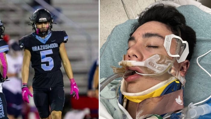 3 Texas teens charged after high school student brutally beaten at party