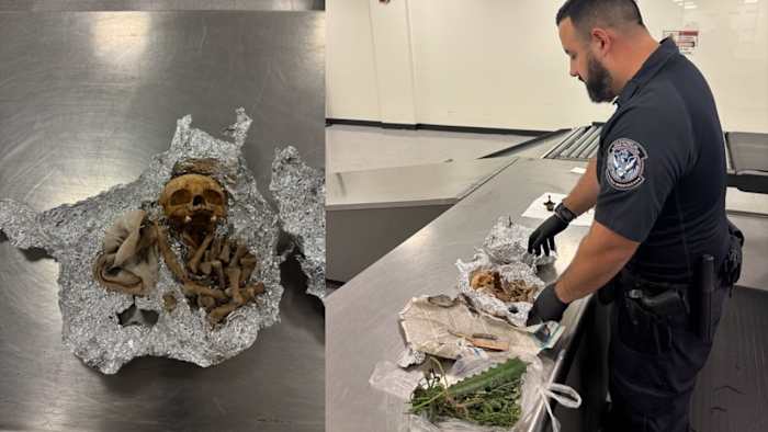 Bony baggage: Customs officials uncover apparent human remains at ...