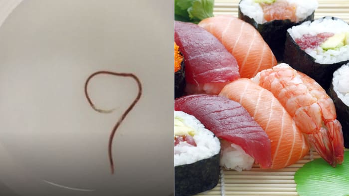 Worm removed from woman’s tonsil 5 days after she ate sashimi, report says